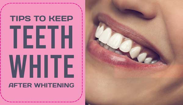 Maintaining White Teeth After Whitening Tip Sand Post Procedure